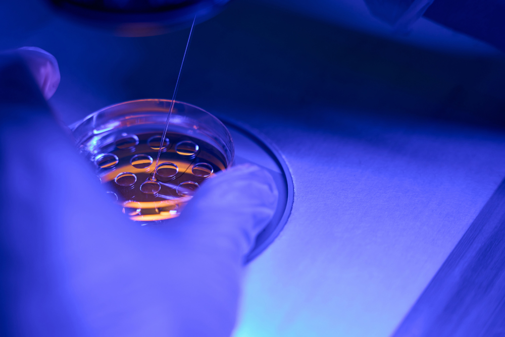 Freeze-All Embryo Transfer for IVF in Los Angeles